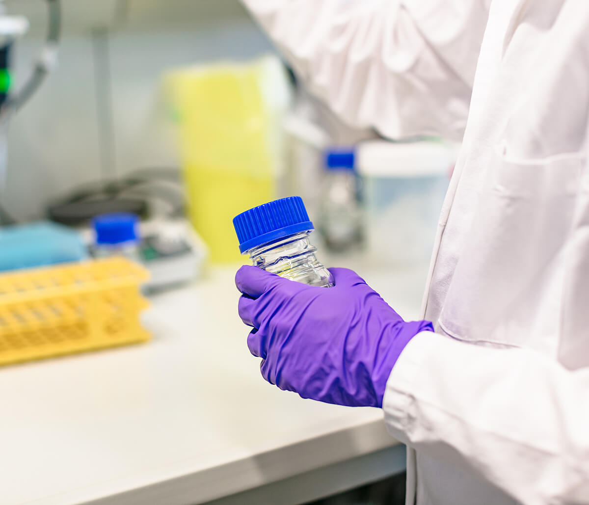 Semen Analysis Frisco TX - Sperm Test Laboratory - Motility Semen Analysis Frisco TX - Sperm Test Laboratory - Motility